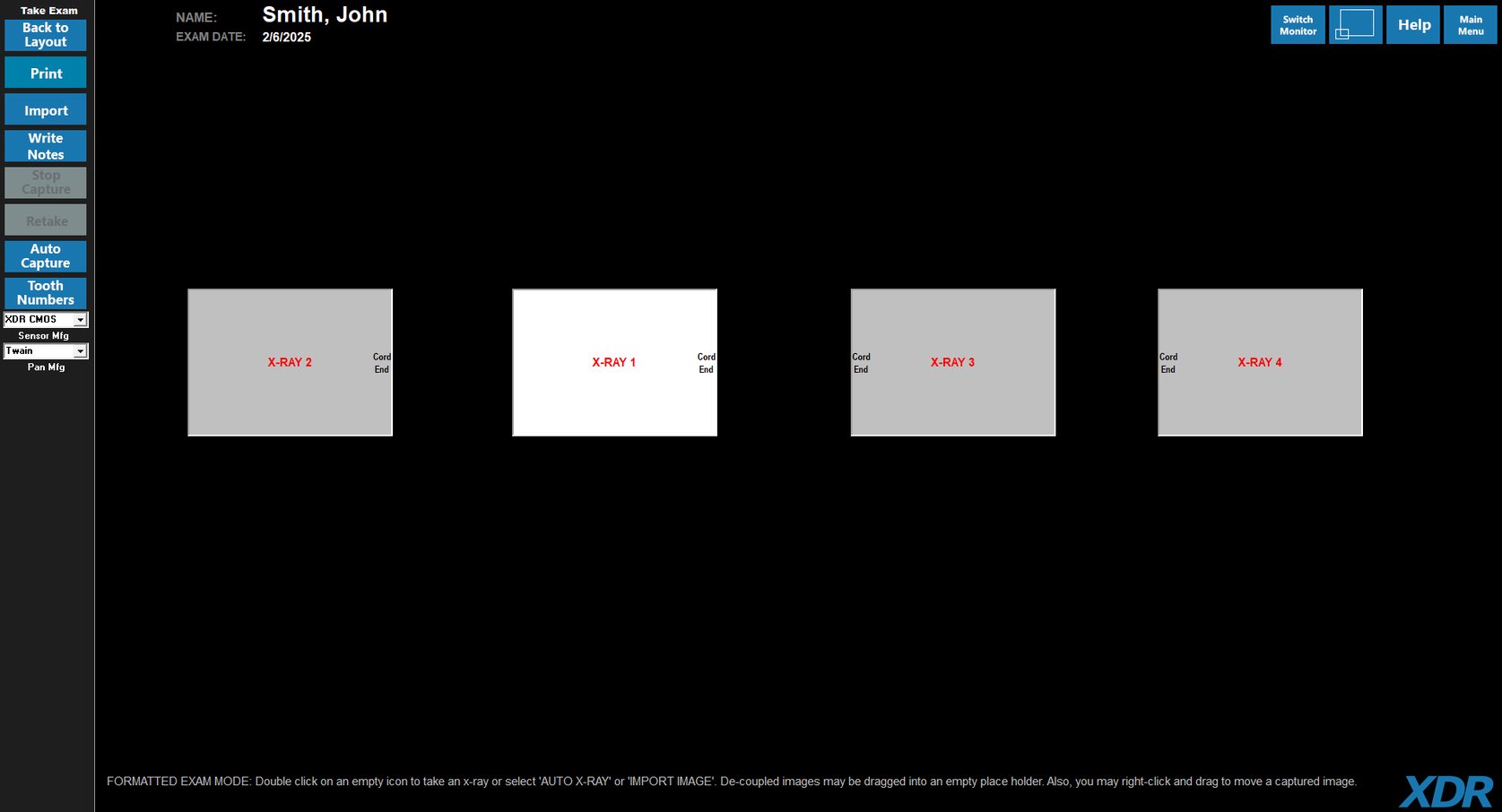 Capture a Series of Radiographs