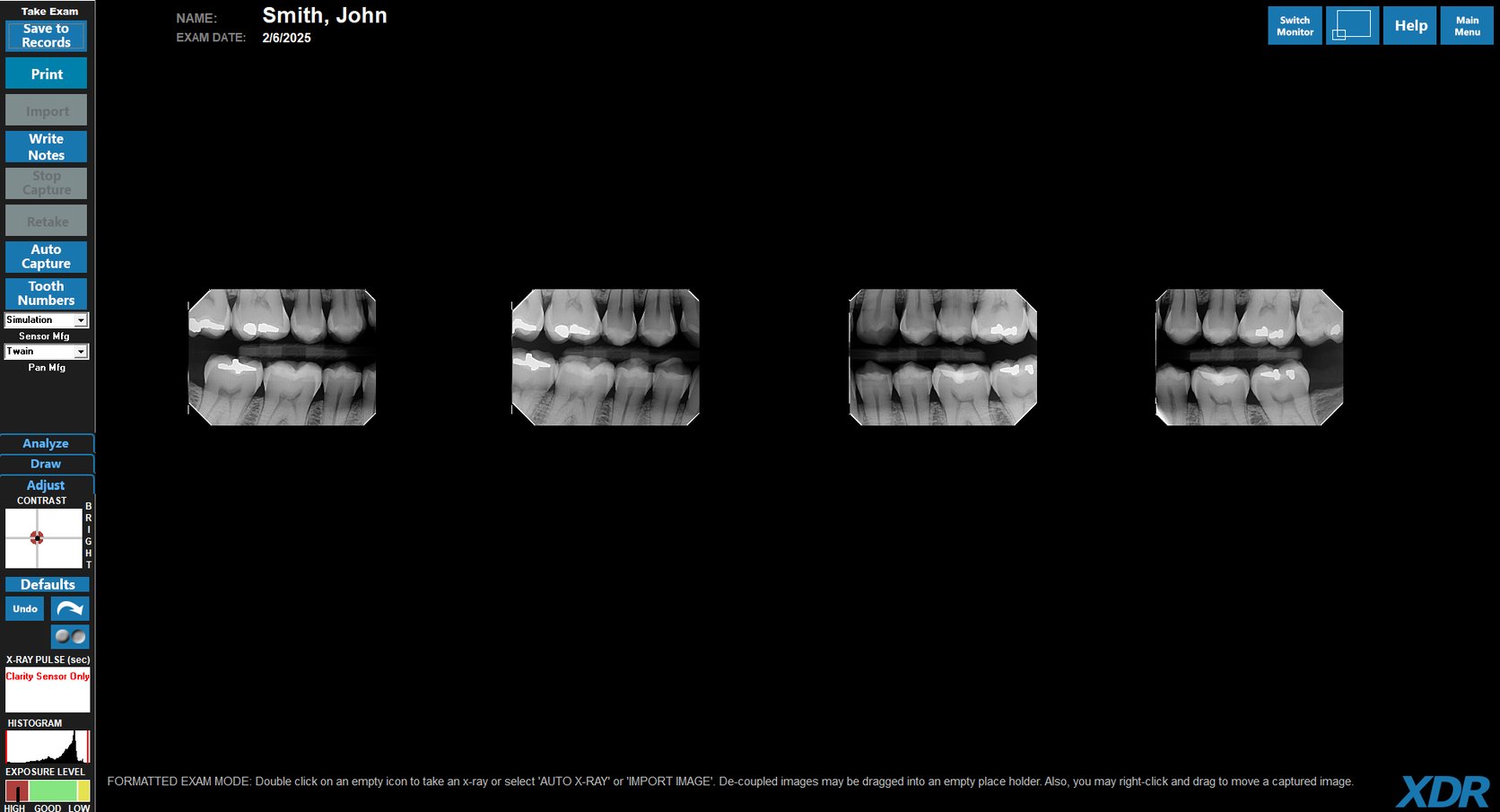 Capture a Series of Radiographs