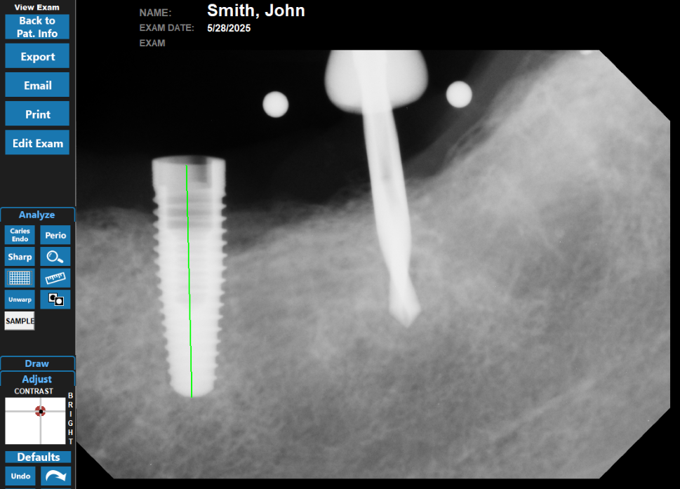 Image Calibration for X-ray Measurement