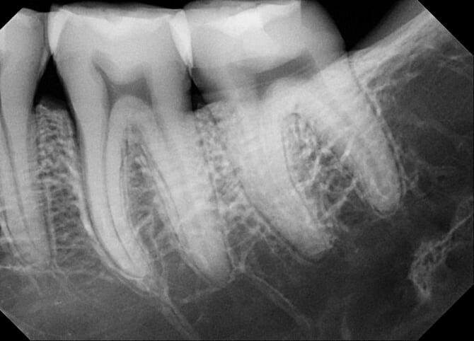 XDR Clarity Sensor Exposure Guidelines